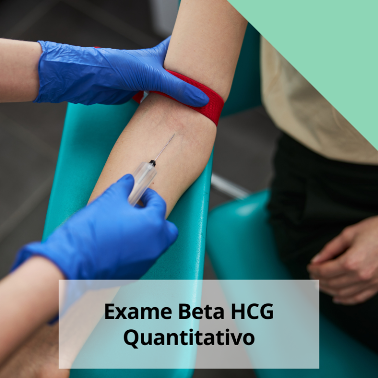 Exame Beta HCG Quantitativo em até 2 dias úteis - Laboratório Niterói